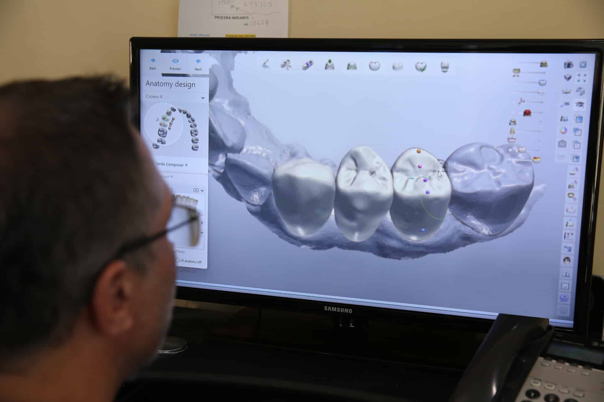 Dental 3D Printing | Innova Dental Lab